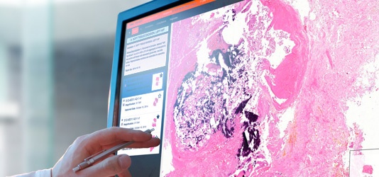 Implementing a Digital Pathology System: Are you up for the challenge?